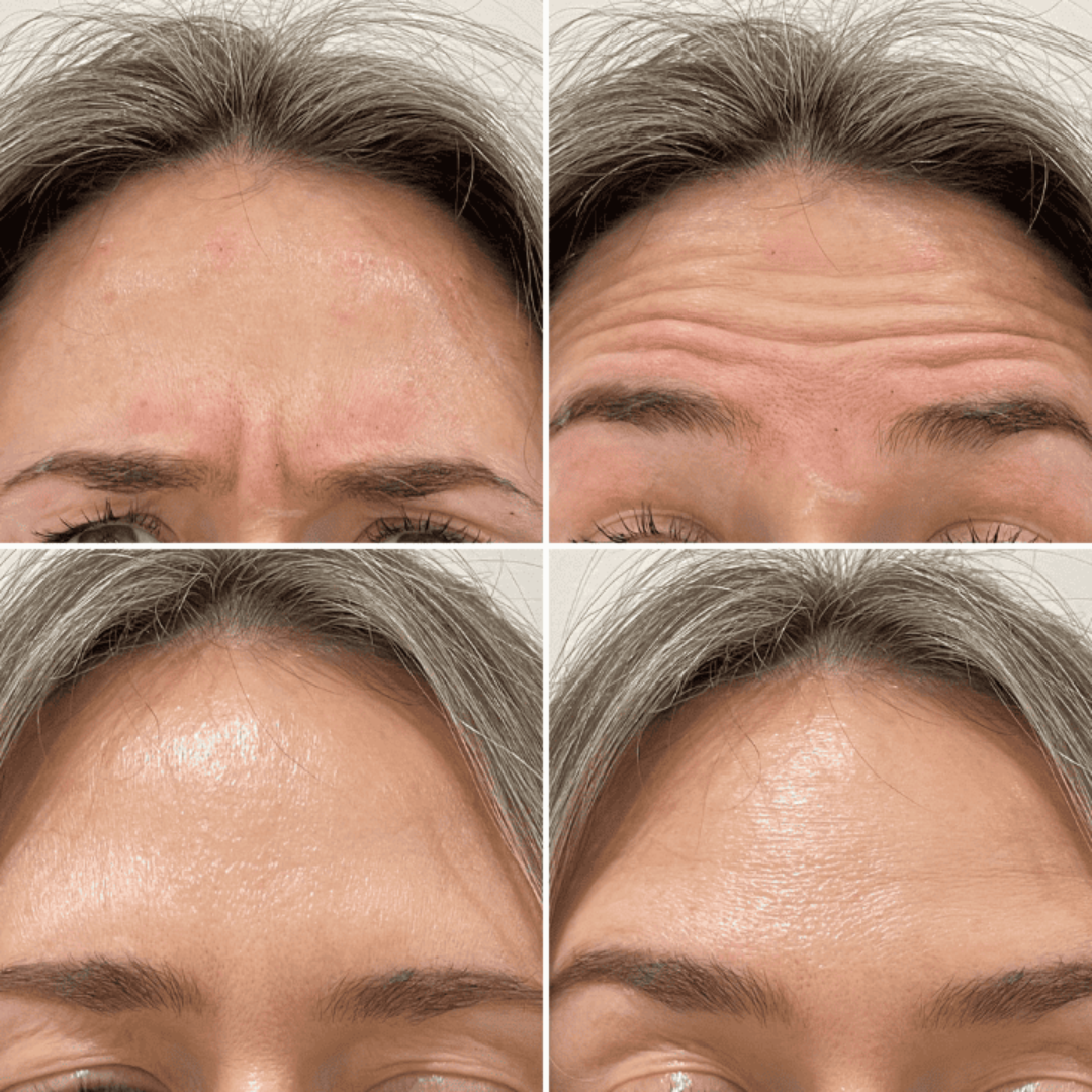 Lift, Tighten & Brighter - Celimax Retinal Glow boosting Cream